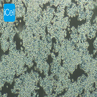 COLO320 人结直肠腺癌细胞-Human Colorectal Adenocarcinoma Cells | EIAab