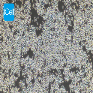 COLO320 DM人结直肠腺癌细胞-原代细胞-STR细胞-细胞培养基-镜像绮点生物