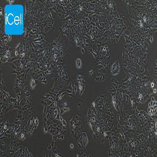 DLD-1 人结直肠腺癌上皮细胞-原代细胞-STR细胞-细胞培养基-赛百慷生物