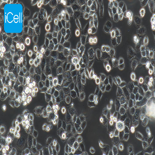 PANC-1 人胰腺癌细胞-原代细胞-STR细胞-细胞培养基-赛百慷生物