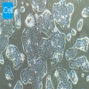 NCI-N87 人胃癌细胞-原代细胞-STR细胞-细胞培养基-赛百慷生物