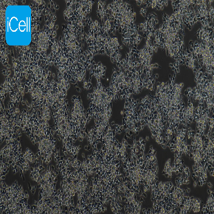 LS174T 人结直肠腺癌细胞-原代细胞-STR细胞-细胞培养基-镜像绮点生物