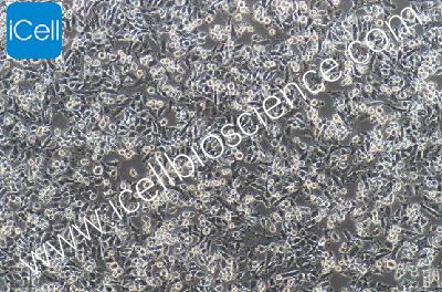 PATU 8988S 人胰腺癌细胞 （暂不提供）-原代细胞-STR细胞-细胞培养基-赛百慷生物