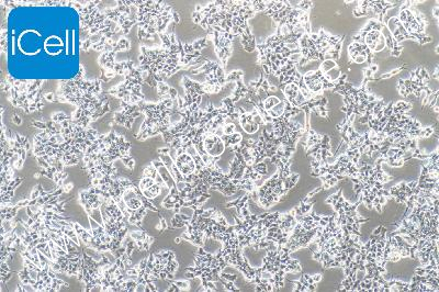 22Rv1 人前列腺癌细胞-原代细胞-STR细胞-细胞培养基-赛百慷生物