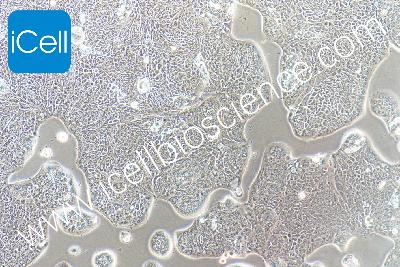 SW1116 人结肠腺癌细胞-原代细胞-STR细胞-细胞培养基-赛百慷生物