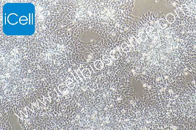 SK-N-MC 人神经上皮瘤细胞-原代细胞-STR细胞-细胞培养基-镜像绮点生物