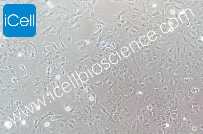 HS578T 人乳腺癌细胞-原代细胞-STR细胞-细胞培养基-赛百慷生物